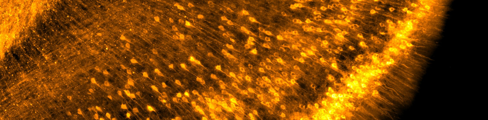 mesoSPIM features - mesospim.org