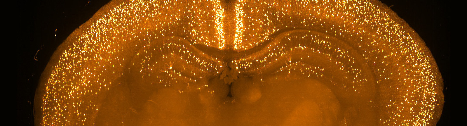 Axially scanned light-sheet microscopy - mesospim.org